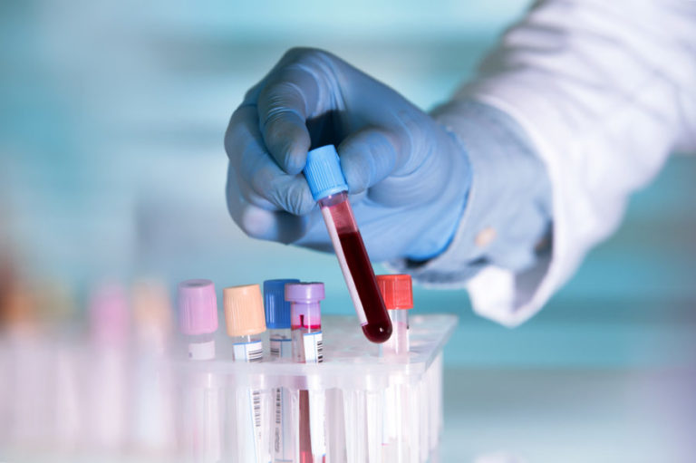 Understanding Your Pet’s Lab Tests | Vet Guide